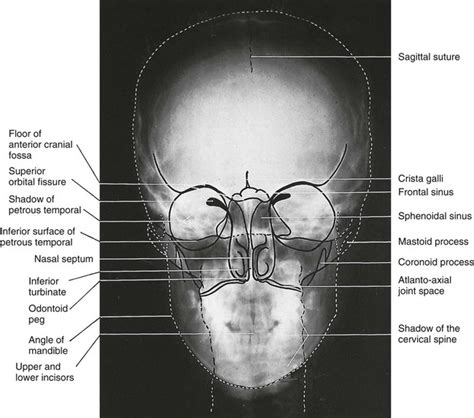 Skull And Maxillofacial Radiography Clinical Gateclinical Gate