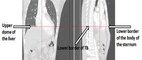 Determination Of The Upper Margin Of Liver Dome Download Scientific