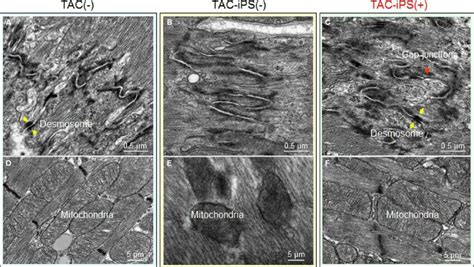 Protection Of Mitochondria And Gap Junction Desmosomal A Through C