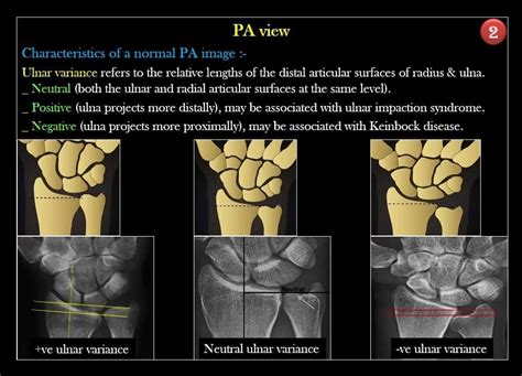 Hounsfield Scale Diagram Radiology Case