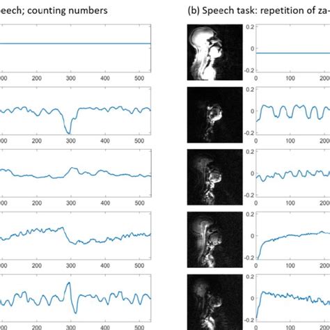 Visualizing The Graph Laplacian Matrix For The Speaking Task Of Download Scientific Diagram