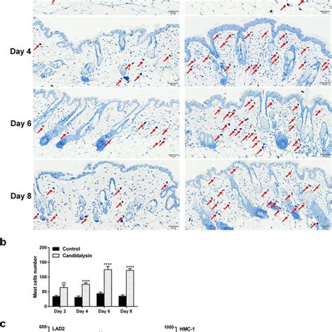 Candidalysin Mediates Mast Cell Migration In Vivo And In Vitro A
