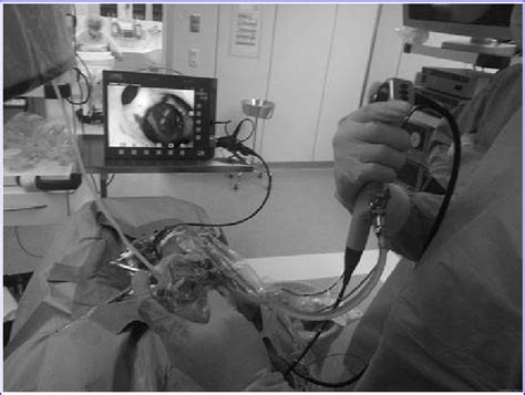 Intraoperative Navigation Download Scientific Diagram