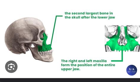 Flat Cheekbones Due To A Recessed Maxilla Rqovesstudio