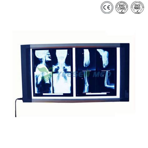 Medical Radiography X Ray Film Viewer High Quality Medical Radiography