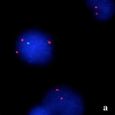 In Situ Detection Of Dna Using Padlock Probes And Target Primed Rolling