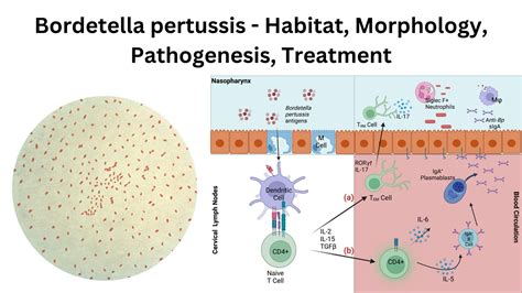 Clostridium Botulinum Overview Biology Notes Online