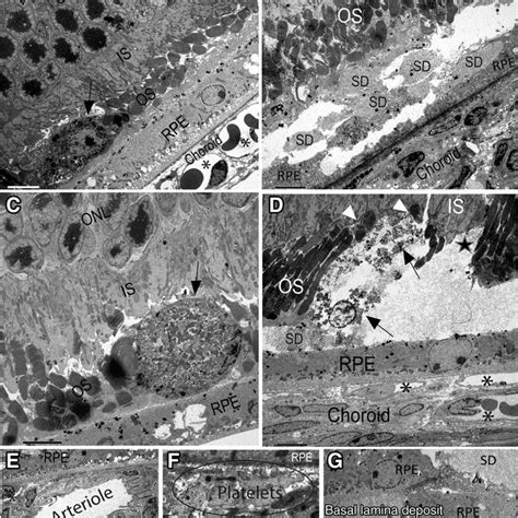 Representative Electron Micrographs Of Ocular Ultrastructure In 18