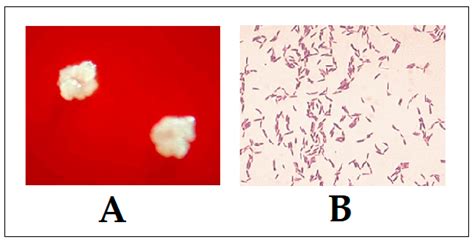 The Pathogenic Role Of Actinomyces Spp And Related Organisms In Genitourinary Infections