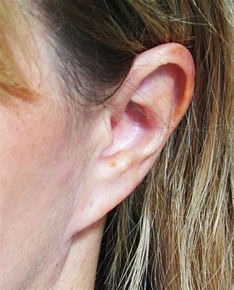 Plastic Surgery 10 Secret Signs