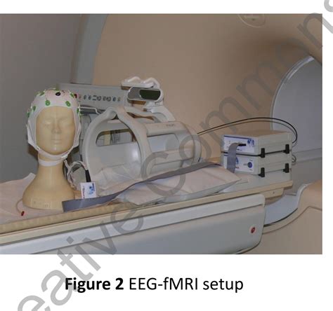Figure 2 From Spatio Spectral Eeg Patterns Of Intrinsic Connectivity Networks Revealed By Eeg
