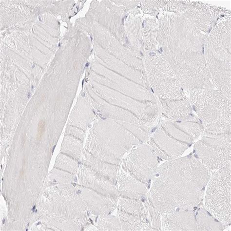 Rabbit Polyclonal Anti Tkt Antibody Buy For Research Highly
