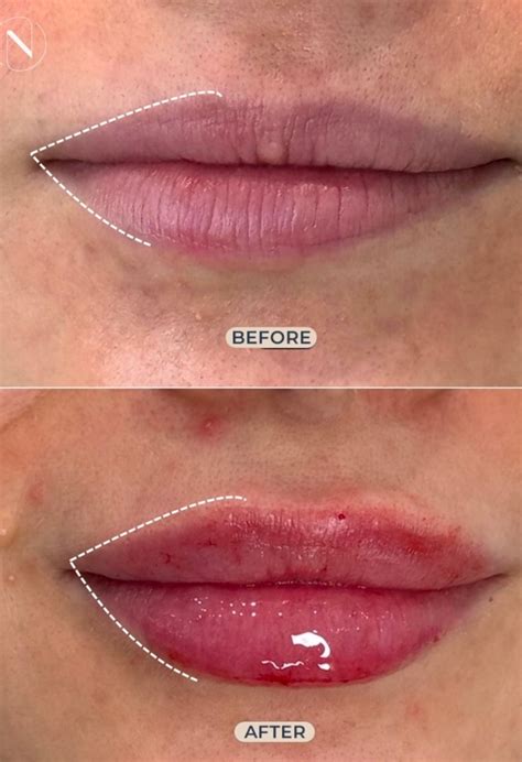 Narjis Al Saedy The Global Aesthetic Visionary Behind The Signature