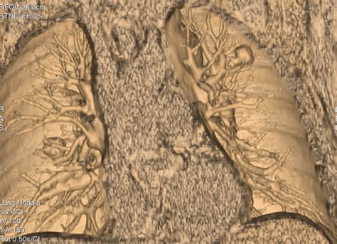 Standardizing Radiation Dose In 4d Ct Imaging