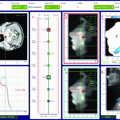 Epid In Vivo Dosimetry Workflow The Ratio R D Iso D Tps Between The Download Scientific