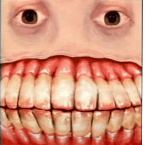 Teeth Cools Nextbots Wiki Fandom