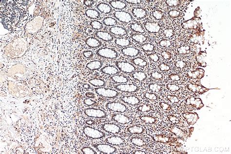 Fus Tls Fusion Protein Ag31799 Proteintech