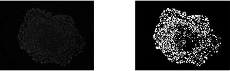Figure 1 From Automatic Cell Detection In Fluorescent Embryonic Stem