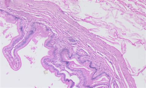 Gallbladder Labeled Histology Dictionary Normal Gallbladder The