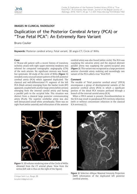 Pdf Duplication Of The Posterior Cerebral Artery Pca Or True Fetal