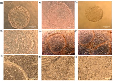 Trophectoderm Cell Culture A Hatched Blastocyst Seeded Onto The