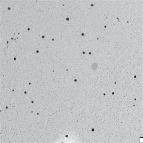 Tem Micrograph Of Anthocyanin Loaded Dextran Nanoparticle Download