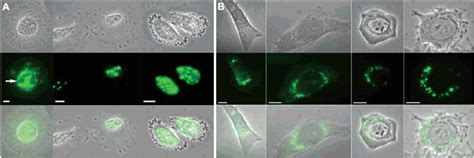 Advanced Photoluminescent Nanomaterials For Targeted Bioimaging Of