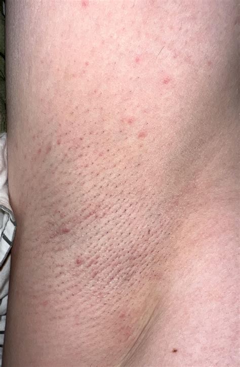 Fresh Pits R Armpitvoyeur