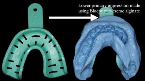 Finlays Newsletter 60 Sylvias Upper Kennedy Class 2 Mod 1 Metal Based