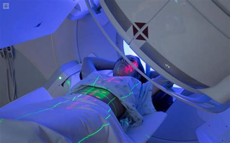 IMRT Radioterapia de Intensidad Modulada: qué es, síntomas y tratamiento | Top Doctors