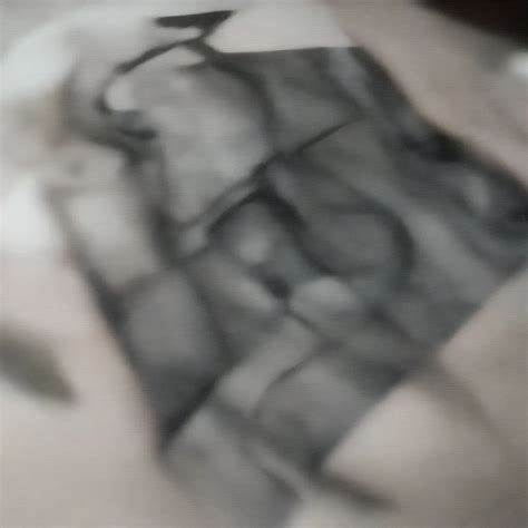 Understanding Herniated Discs In The Shoulder