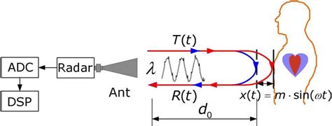 Scenario Of Doppler Radar Noncontact Vital Sign Detection Download Scientific Diagram