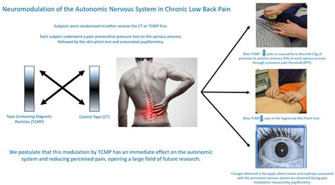 Neuromodulation Of The Autonomic Nervous System In Chronic Low Back