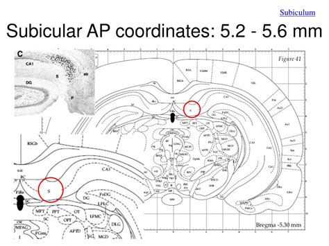 Ppt Why Are There Parallel Hippocampal Diencephalic Pathways For Event Memory Powerpoint