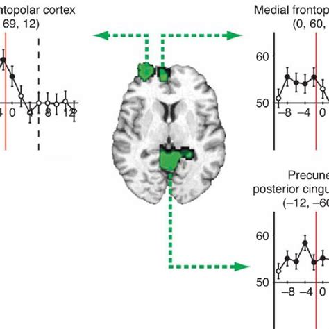 Decoding Outcome Of Decisions Over Time Before They Were Reported To