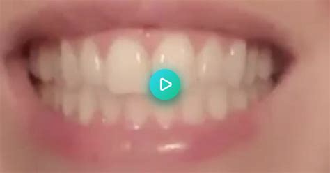 Teeth Album On Imgur