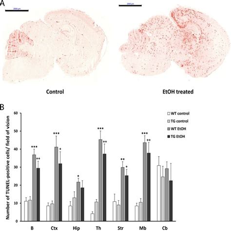 Apoptotic Cell Death Detection Using Tunel Assay 24 H After Etoh