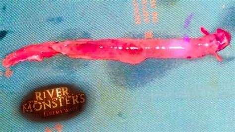 Removing A Candiru From Mans Penis Horror Story River Monsters
