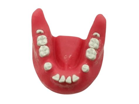 Practice Jaws Impacted Tooth Extraction Surgery Dental Jaw Model