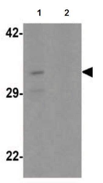 Anti Clec2a Antibody Abc328