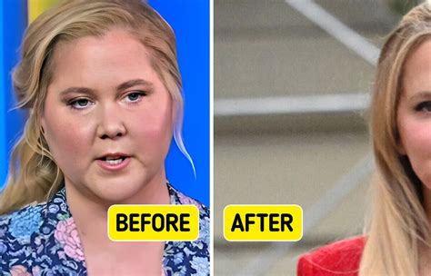 Looked Better Before” Amy Schumer Unrecognizable After Major Body