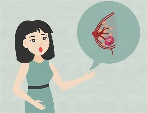 乳腺癌防治月 粉红杀手”悄悄来袭，女性何以远离 胸”险 健康160