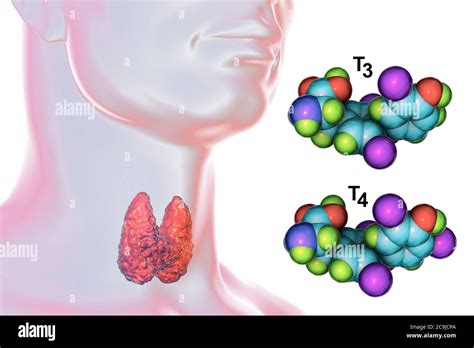 Molecules Of Thyroid Hormones Triiodothyronine T3 And Thyroxine T4 Computer Illustration