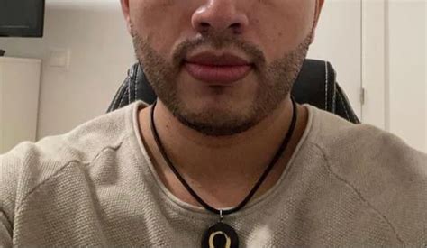 Caso Dr Ssa Özlem BiÇer 3870 Grafts Fue Ricostruzione Barba Bellicapelli Forum