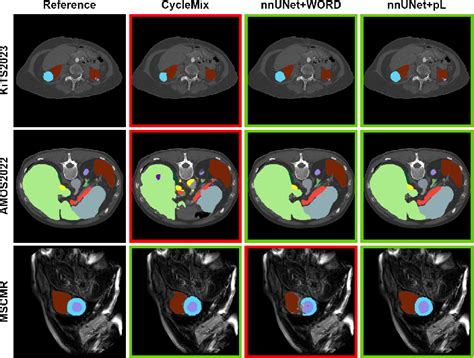 Figure 3 From Embarrassingly Simple Scribble Supervision For 3d Medical Segmentation Semantic