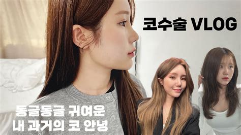 Vlog 다시는 없을 코성형 브이로그 Youtube