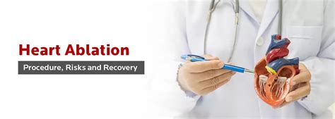 Cardiac Ablation A Complete Guide To Procedure And Recovery