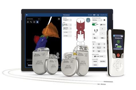 Boston Scientific Obtains Ce Mark For Image Guided Programming Software In Dbs