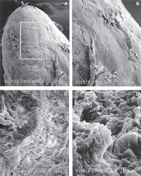 Sem Micrographs Of The Apical Root Third Of Newly Extracted Teeth A