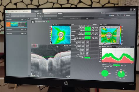 Installation Soct Par Kasi Medical Solutions